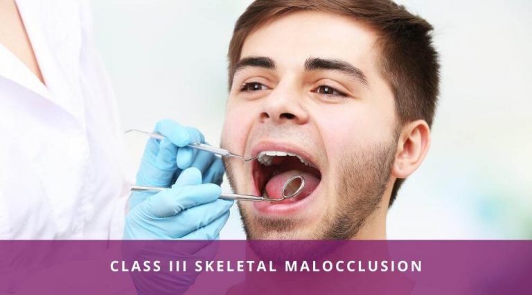 Class III skeletal malocclusion – Richardson's Plastic Surgery Hospitals