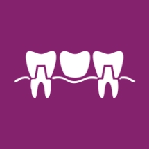 Fixed Partial Denture – Richardson's Plastic Surgery Hospitals
