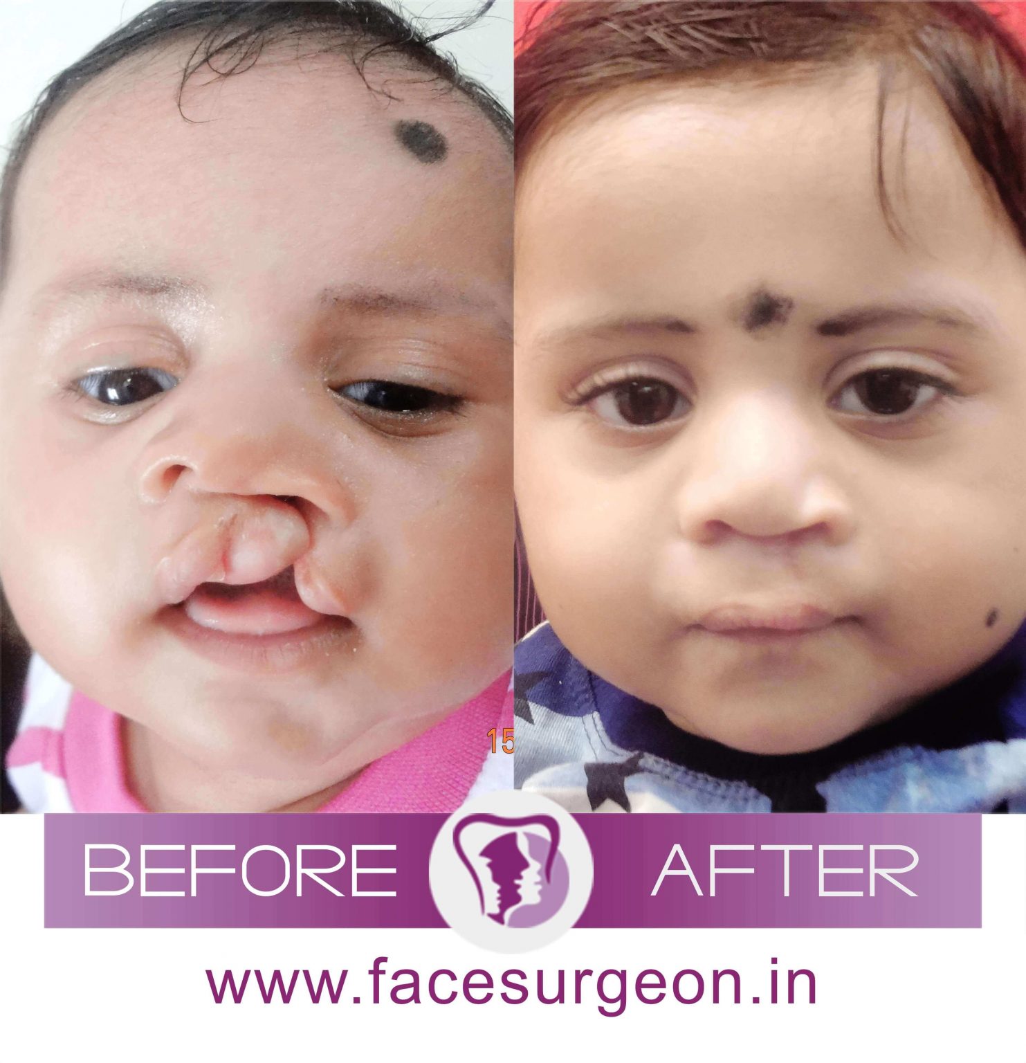 Facial Plastic Surgery Images | Richardsons Hospital