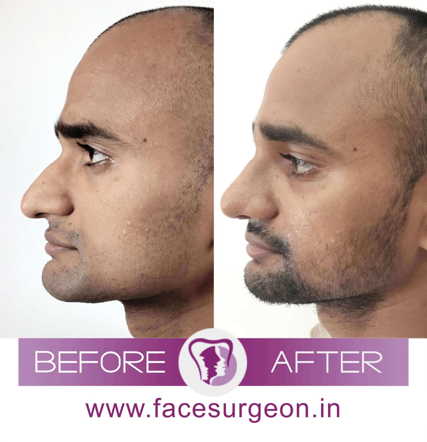 Facial Plastic Surgery Images | Richardsons Hospital