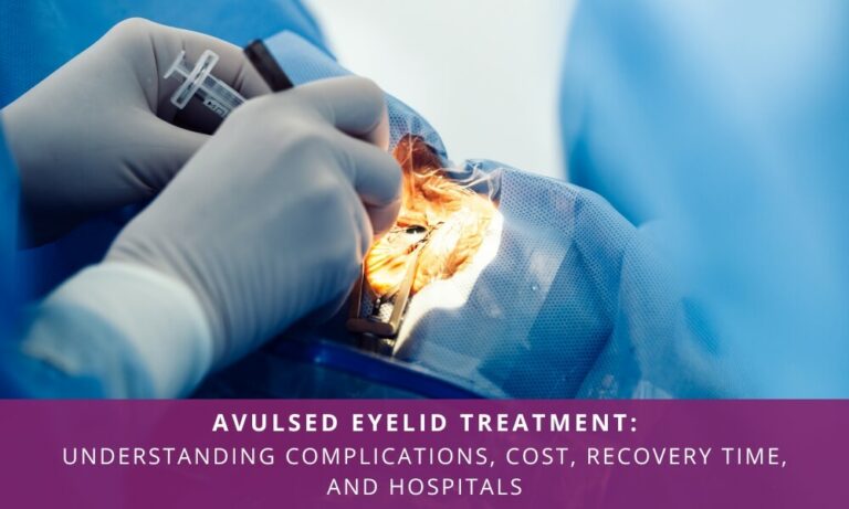 Avulsed Eyelid Treatment In India: Understanding Complications, Cost ...