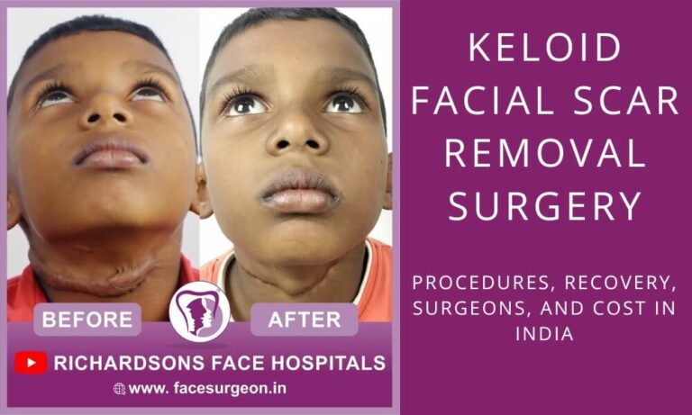 Keloid Facial Scar Removal | Procedures, Recovery, Surgeons, and Cost ...