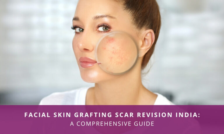 Facial Skin Grafting Scar Revision India: A Comprehensive Guide ...