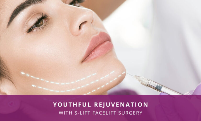 How To Achieve Youthful Rejuvenation With S-Lift Facelift Surgery ...