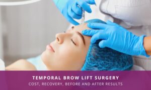 Temporal Brow Lift Surgery: What Is It, Cost, Recovery, Before and ...