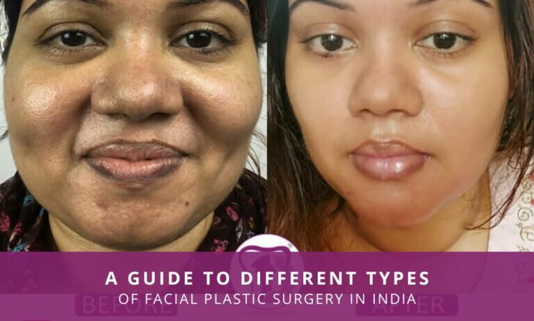 A Guide To Different Types Of Facial Plastic Surgery In India ...