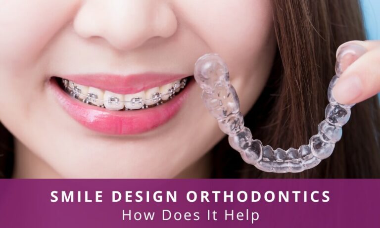Smile Design Orthodontics: How Does It Help? – Richardson's Plastic ...