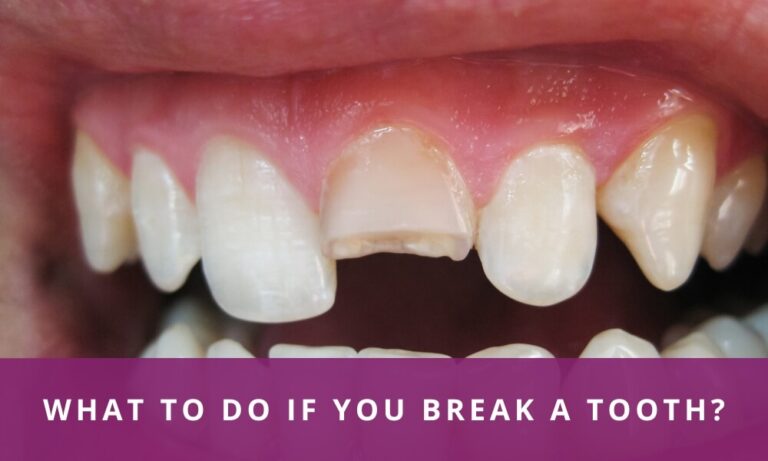 What To Do If You Break A Tooth? – Richardson's Plastic Surgery Hospitals