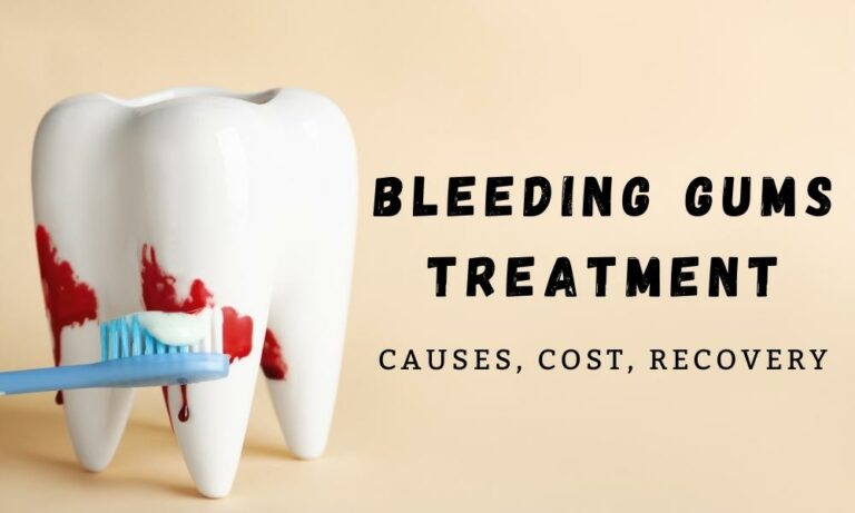 Bleeding Gums Treatment: Causes, Cost, Recovery – Richardson's Plastic ...