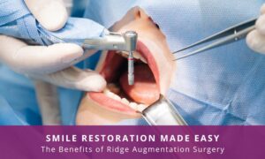 Smile Restoration Made Easy | The Benefits Of Ridge Augmentation ...