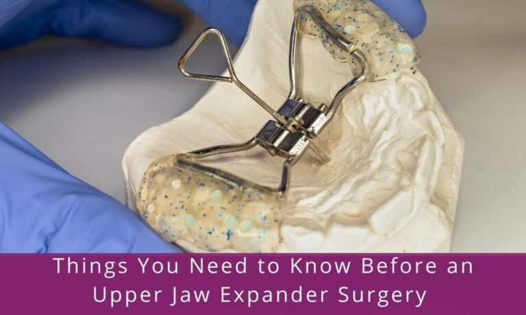 Things You Need to Know Before an Upper Jaw Expander Surgery ...