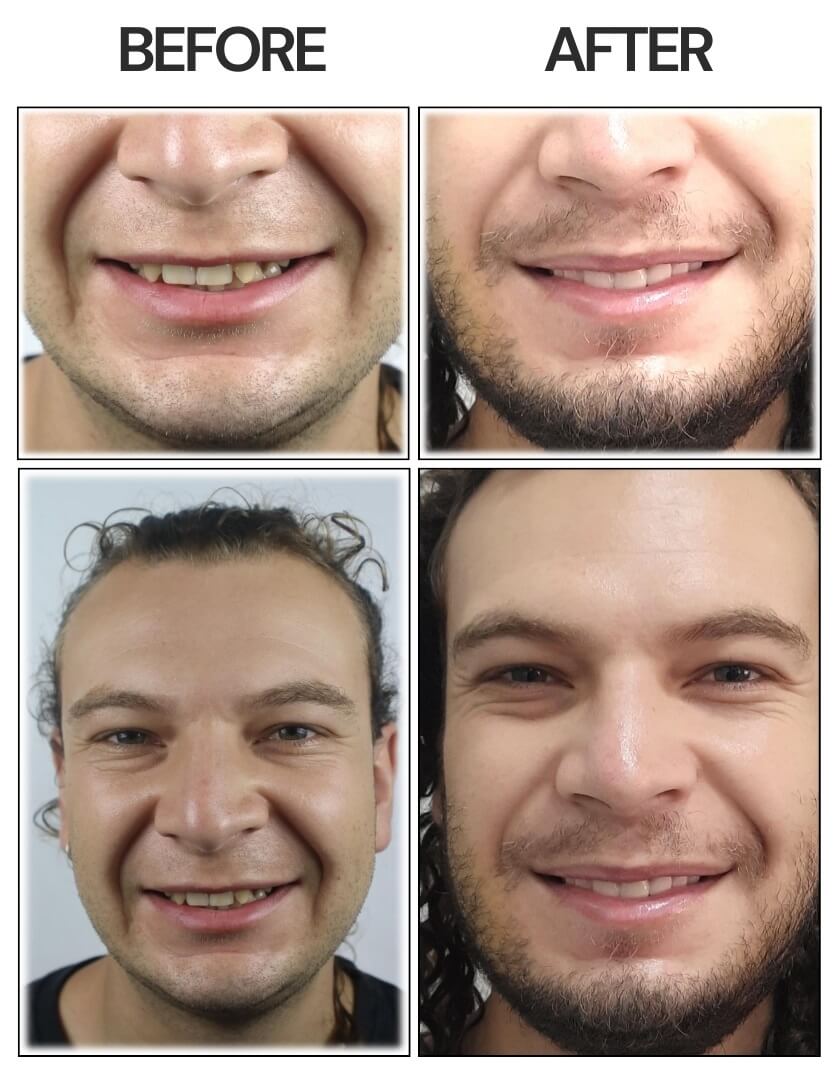 Smile Designing | Joshua Anthony – Richardson's Plastic Surgery Hospitals