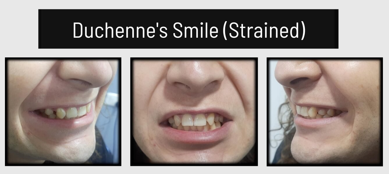 Smile Designing | Joshua Anthony – Richardson's Plastic Surgery Hospitals