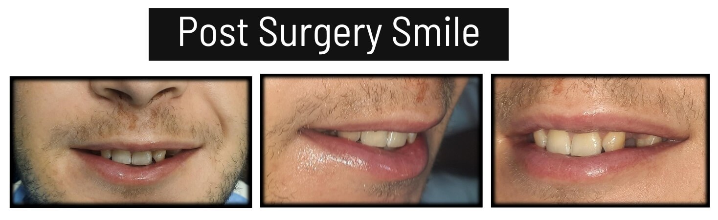 Smile Designing | Joshua Anthony – Richardson's Plastic Surgery Hospitals