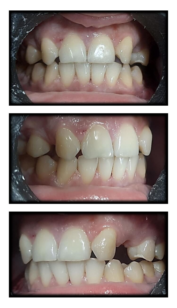 Smile Designing | Joshua Anthony – Richardson's Plastic Surgery Hospitals