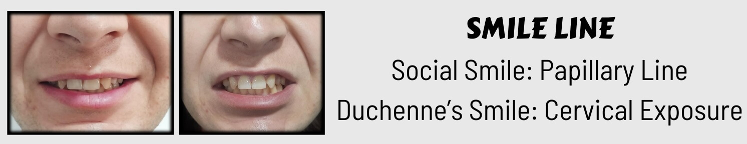 Smile Designing | Joshua Anthony – Richardson's Plastic Surgery Hospitals