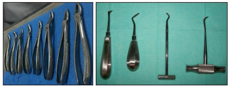 Dental Extraction | A Comprehensive Guide to Procedure, Reasons, and ...