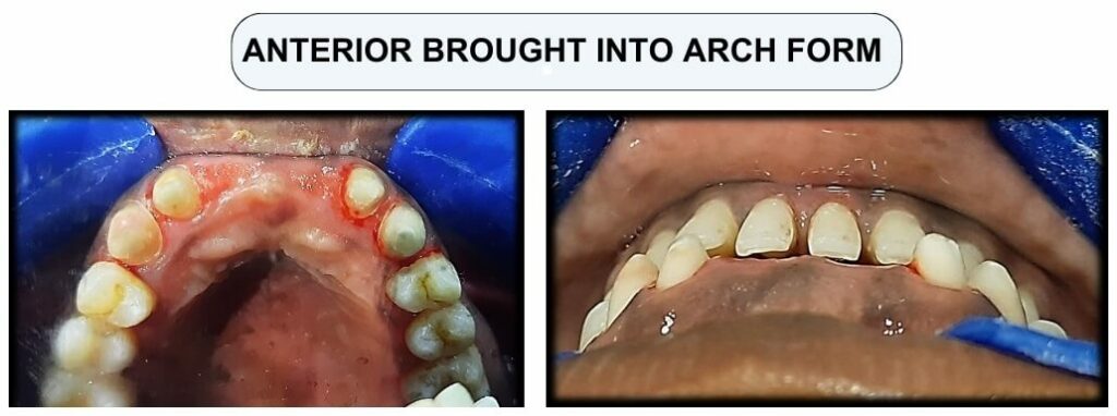Smile Re-Designing Prosthetic Bridge Change – Richardson's Plastic ...