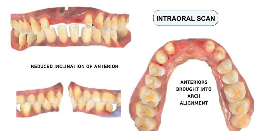 Smile Re-Designing Prosthetic Bridge Change – Richardson's Plastic ...